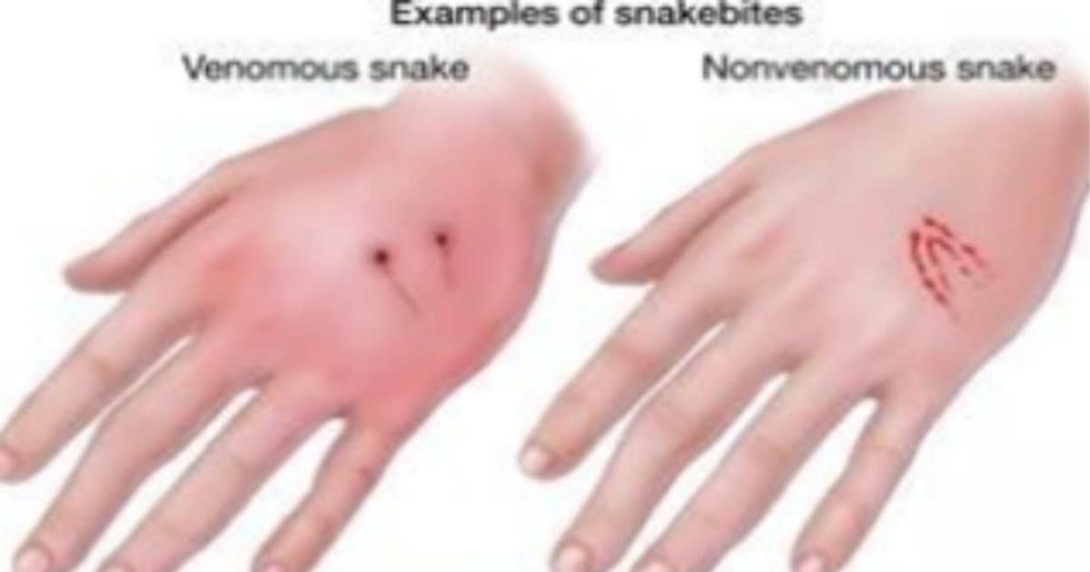 🐍 Snake Smart! How to Identify Venomous vs. Non-Venomous Snakes and ...